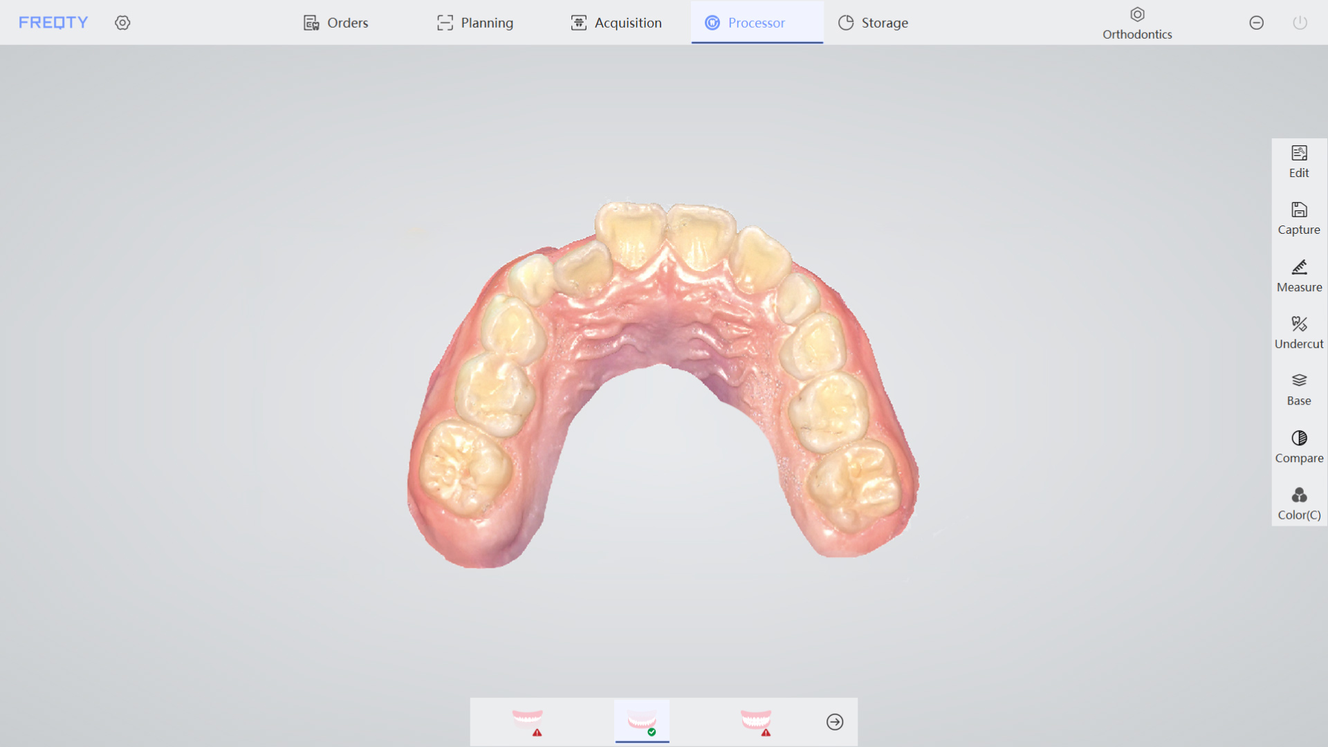 3D Dental Scanning: The Modern Standard of Precision and Comfort - My DENT